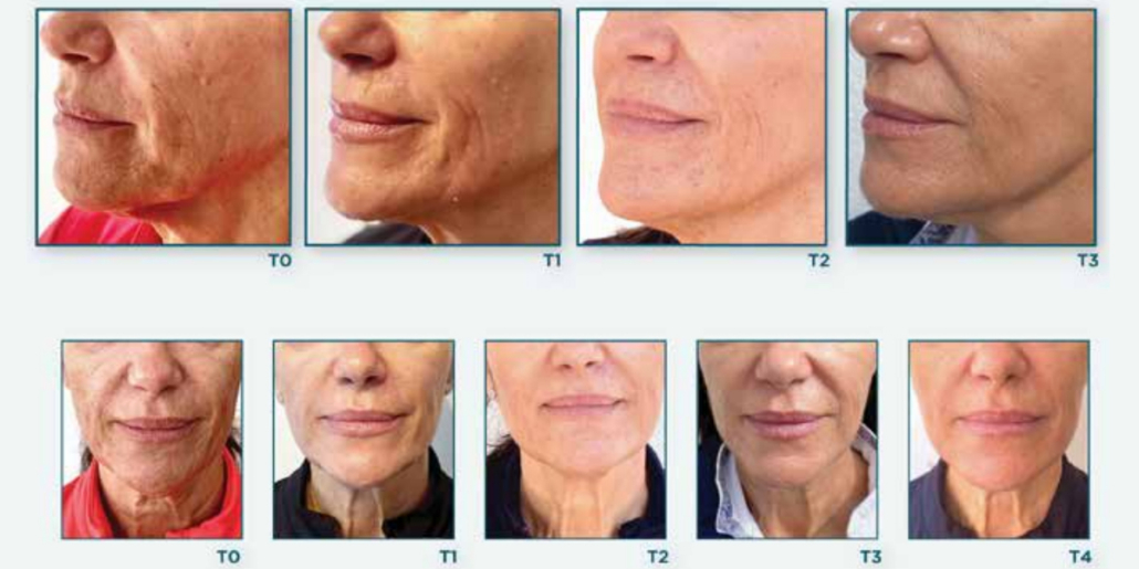 PRODUKTIL - Consulta del Dr. Colomer